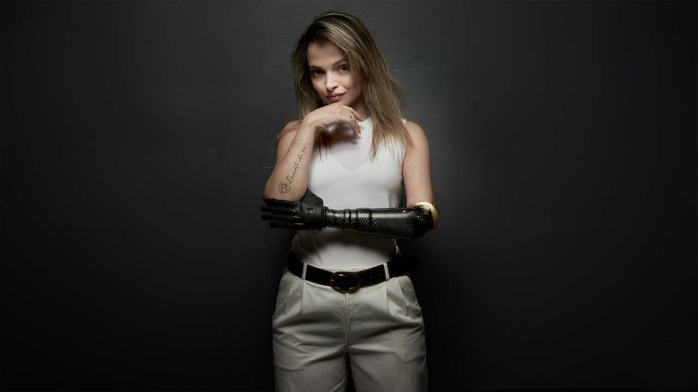 Anna Fusco On Her Journey To Get A COVVI Hand | COVVI Ltd