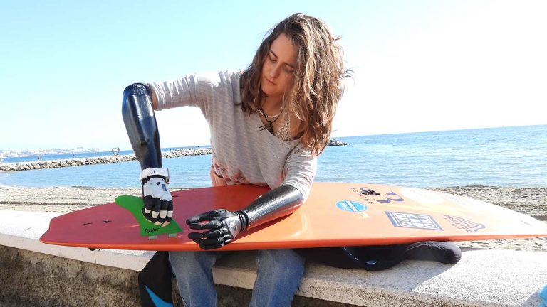 COVVI Ltd | Leading Manufacturer Of Upper-Limb Prosthetics